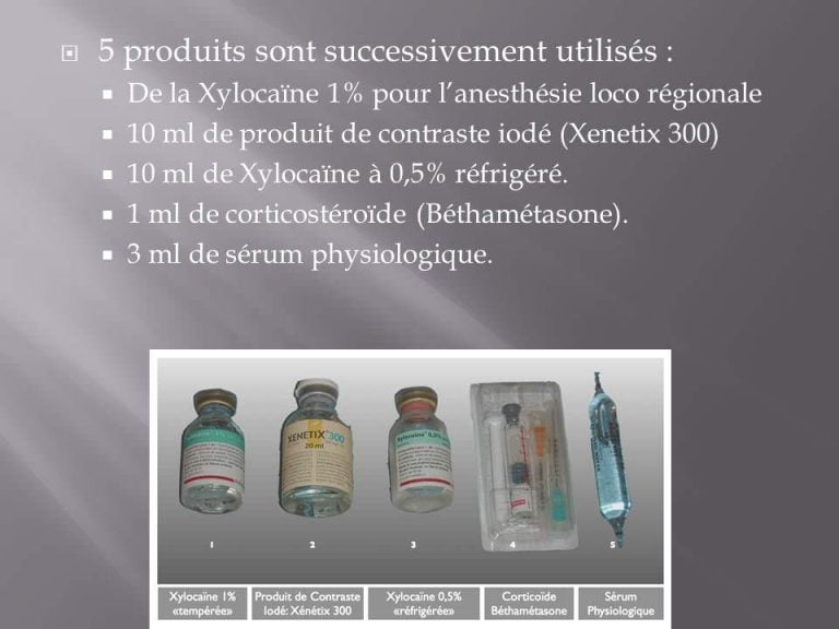 La-capsulite-rétractile-de-A-à-Z-2 – INTERVENTIONAL RADIOLOGY