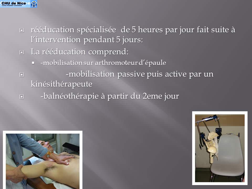La capsulite rétractile de A à Z 3 – INTERVENTIONAL RADIOLOGY